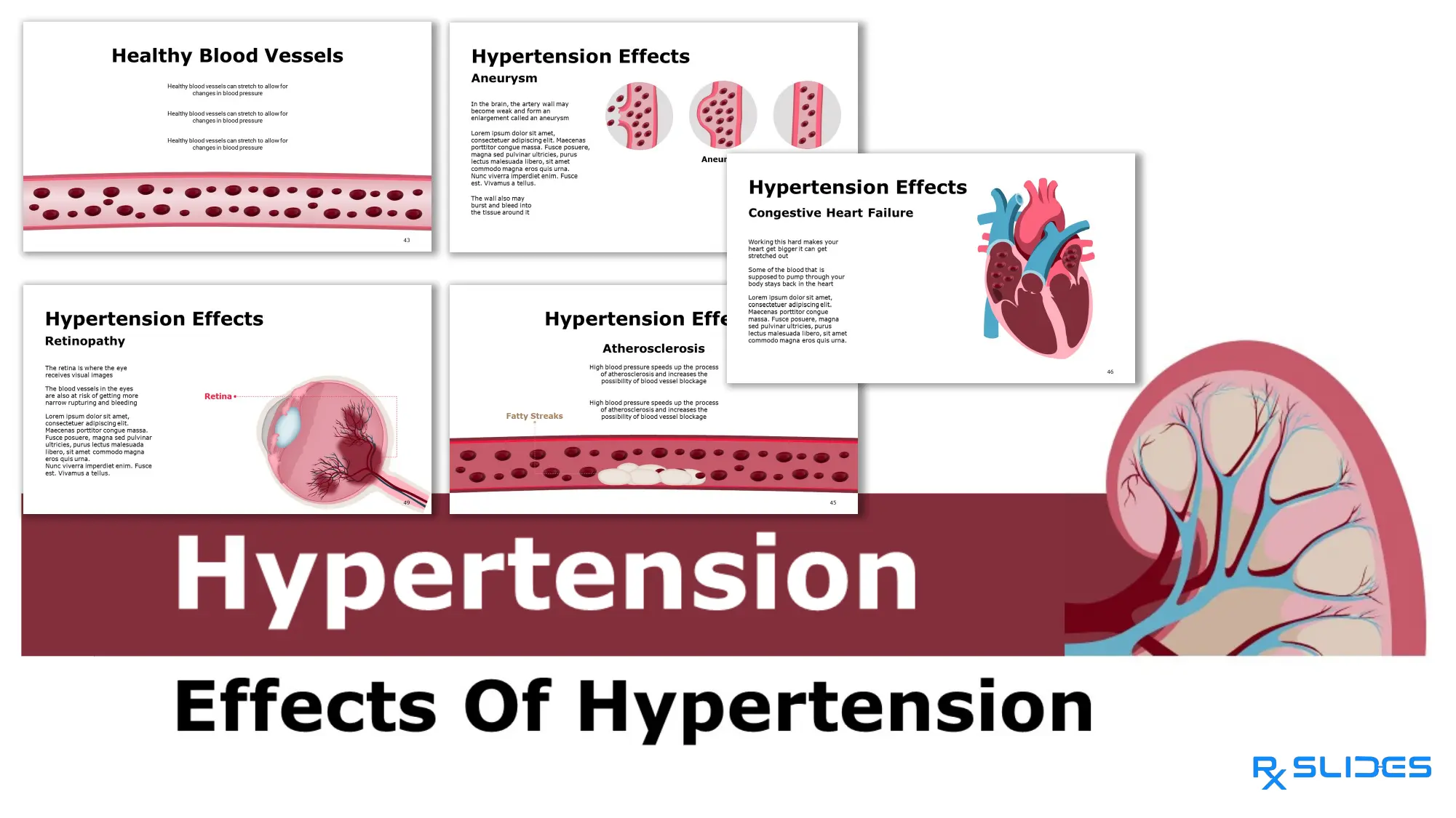 Download Hypertension PowerPoint Template 2| RxSlides Download Hypertension PowerPoint Template 2| RxSlides